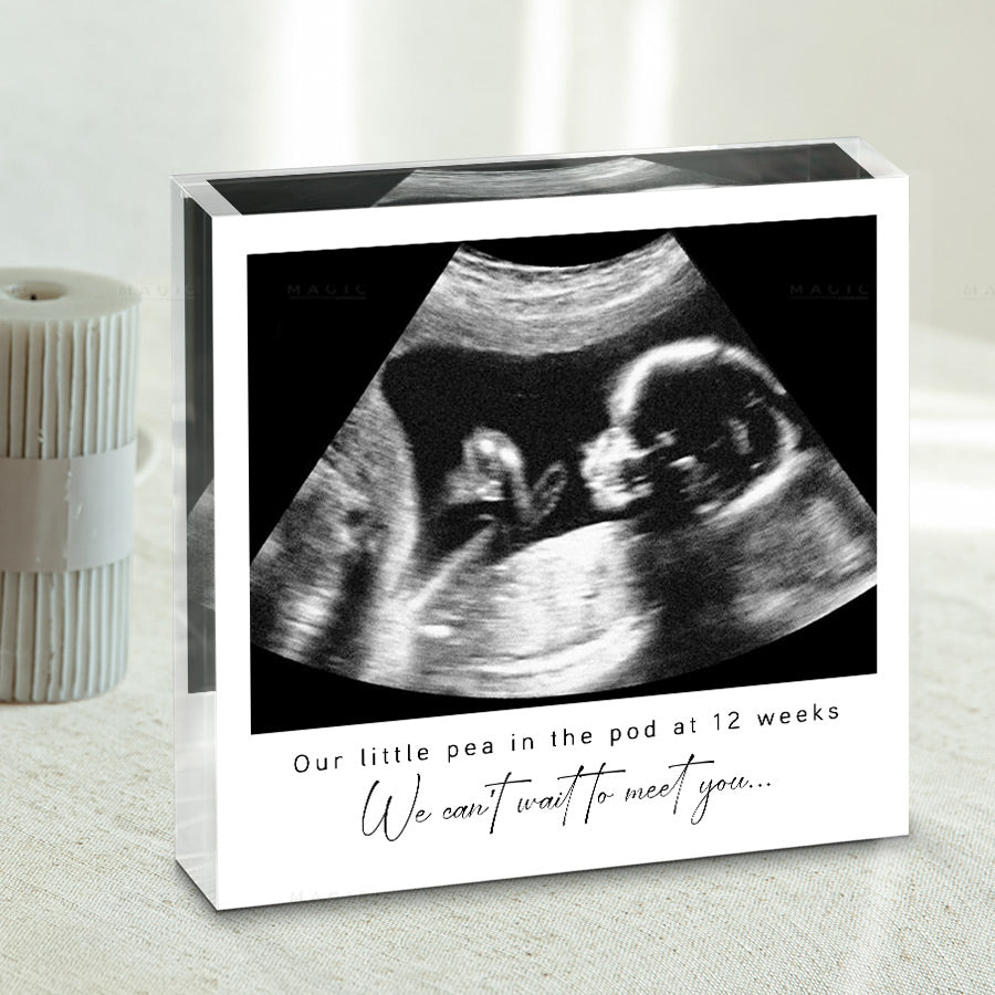 Mom To Be Mothers Day Gift | Custom Acrylic Photo Block | Ultrasound ...